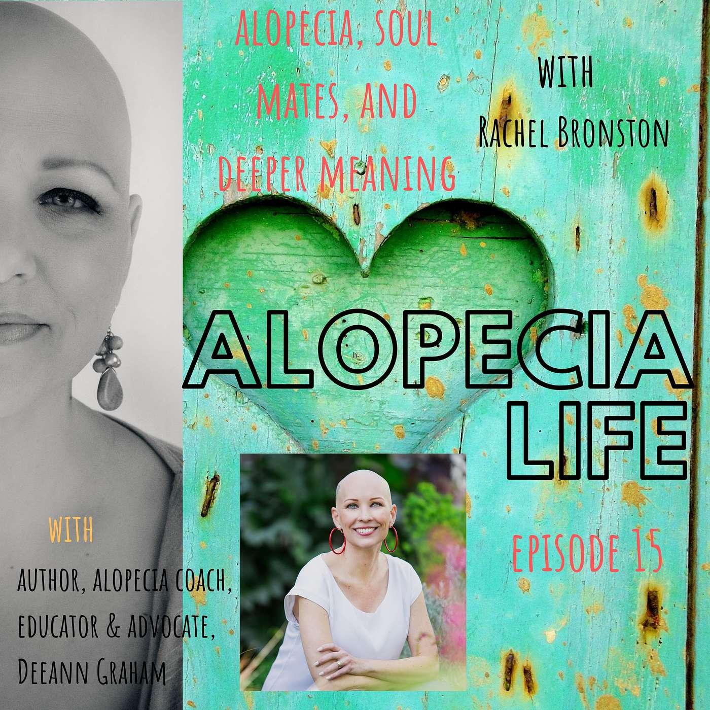 E015 Alopecia, Soul Mates & Deeper Meaning with Rachel Bronston ...