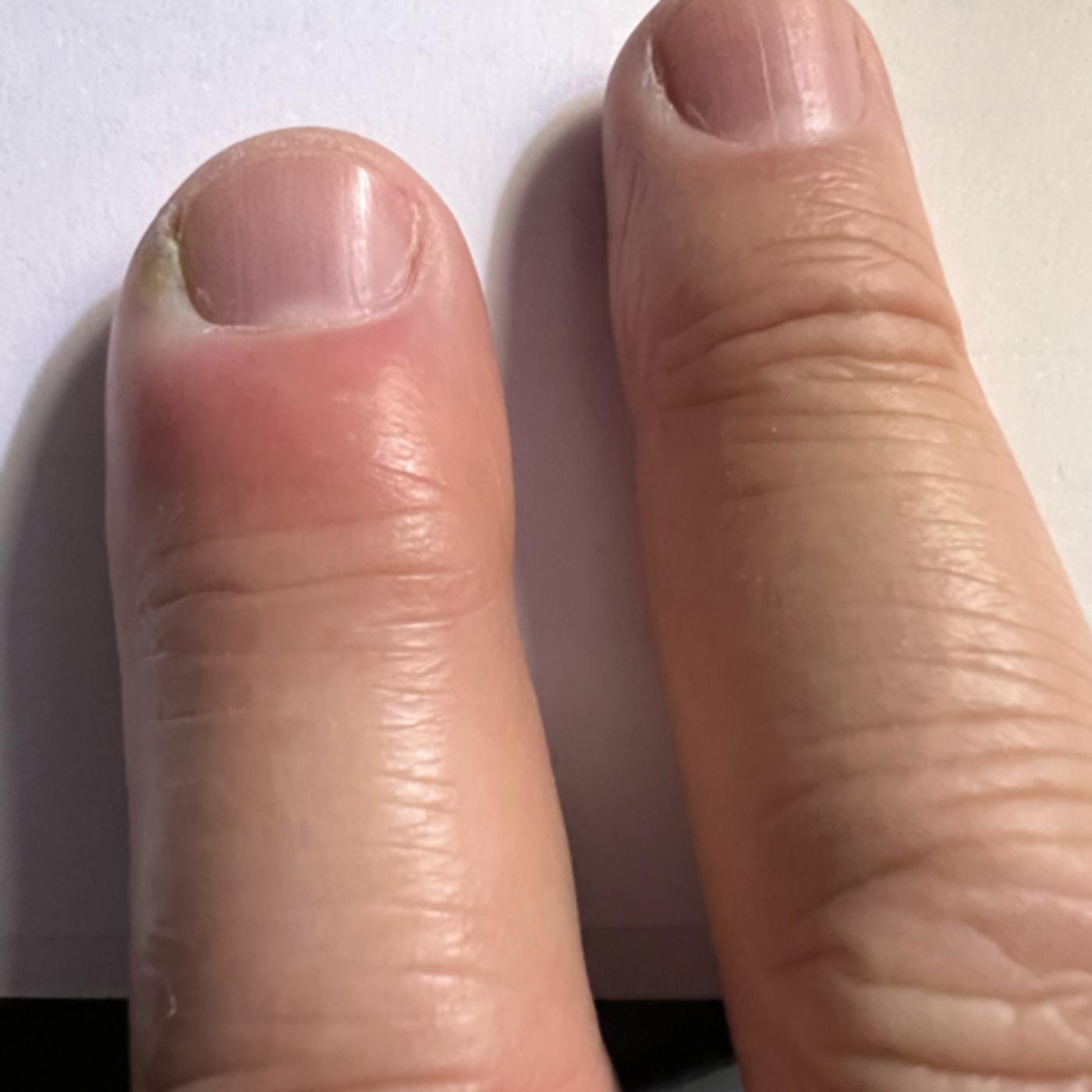 LA FALANGETA DEL DEDO ÍNDICE EN LA BÚSQUEDA DE LA UNIDAD CON UNO MISMO ...