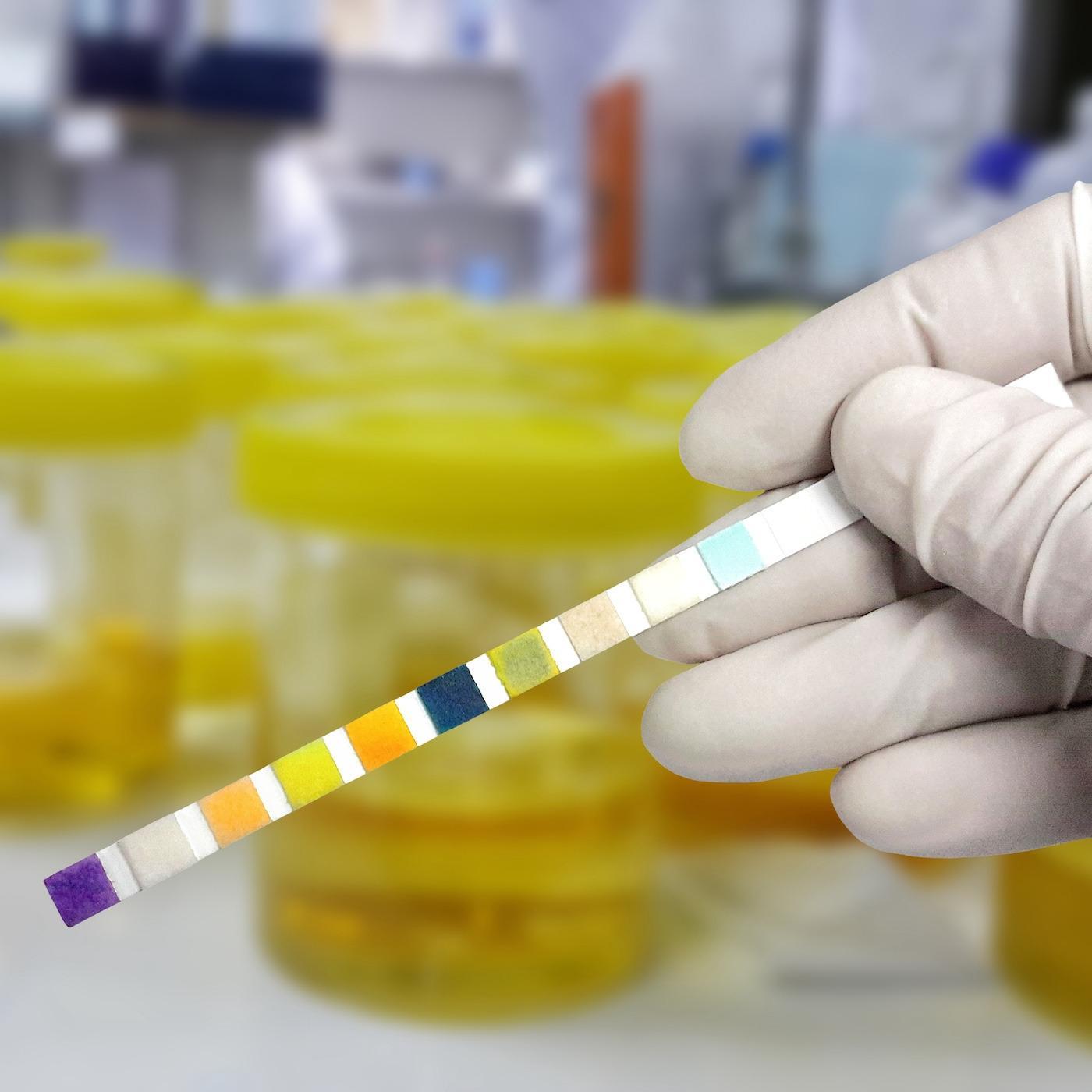 Pediatric UTI and Pneumonia - EMplify by EB Medicine (podcast) | Listen ...