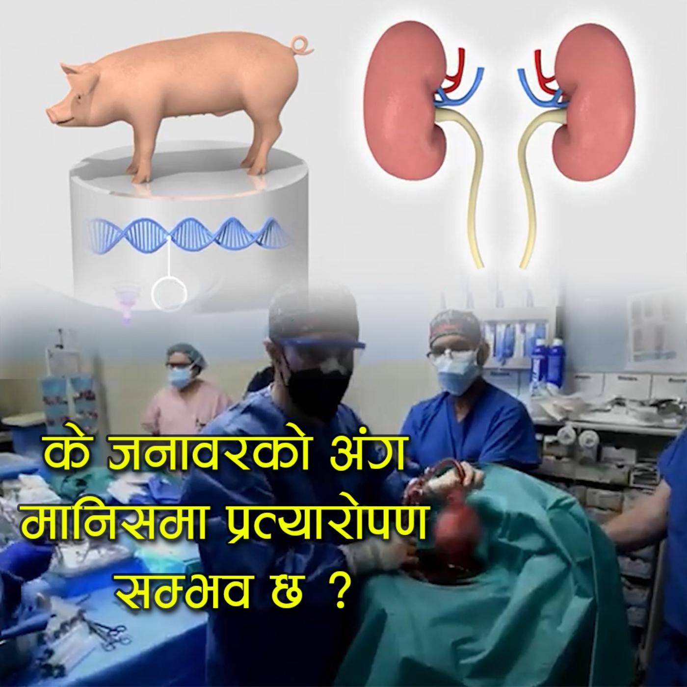 Kantipur Explained (podcast) - ekantipur | Listen Notes