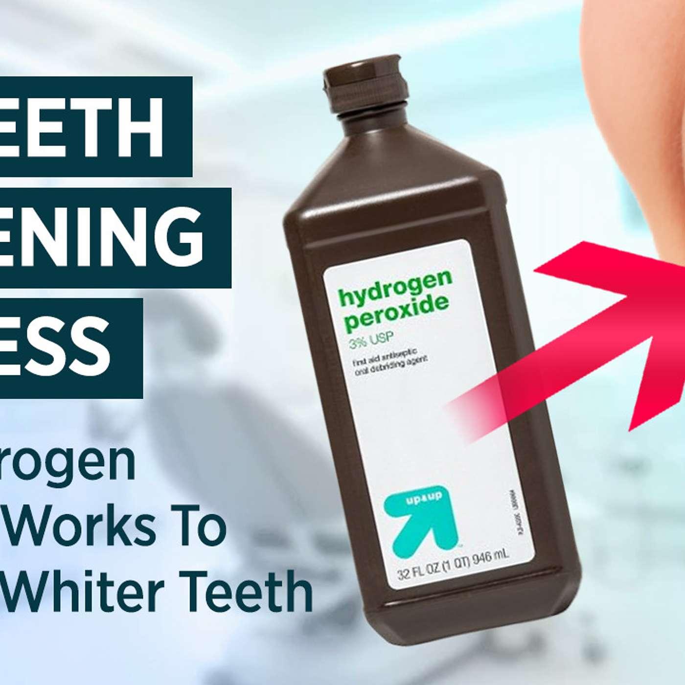 The Teeth Whitening Process: How Hydrogen Peroxide Works To Give You ...