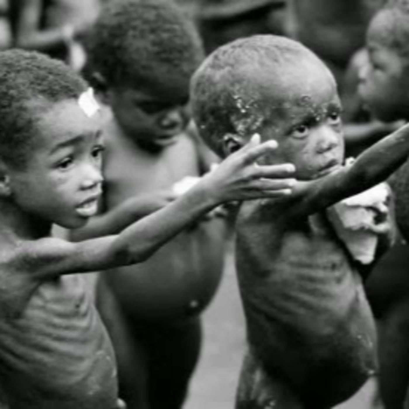 Marasmo y kwashiorkor en etapa infantil - Marasmo y kwashiorkor en ...