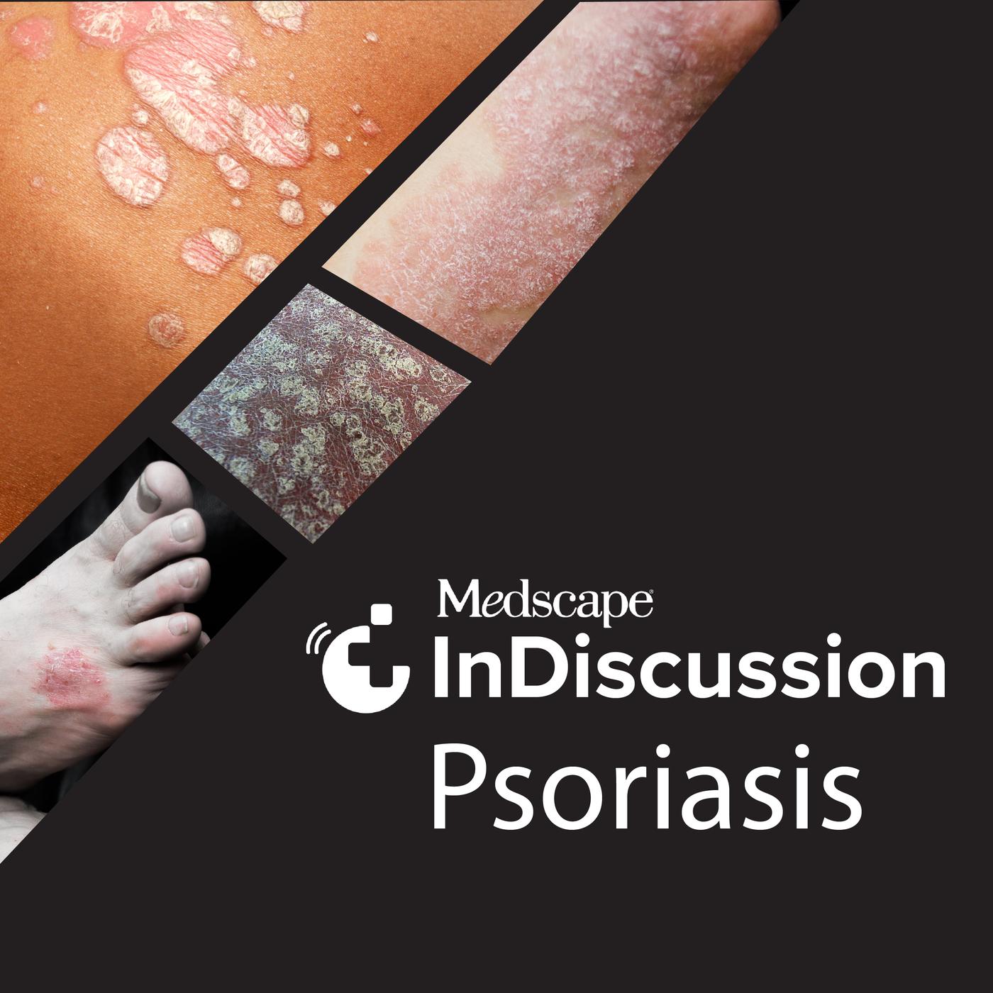 S1 Episode 5: Psoriasis Oral Agents: What to Know to Prescribe Like a ...