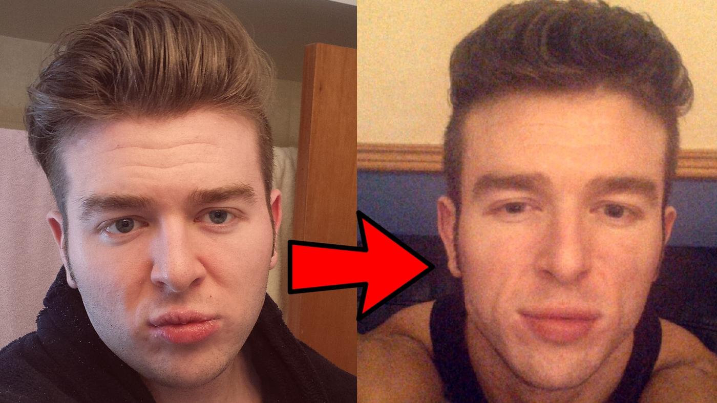 Mewing For Facial Structure And Sleep Apnea Treatment – My Mewing Log ...