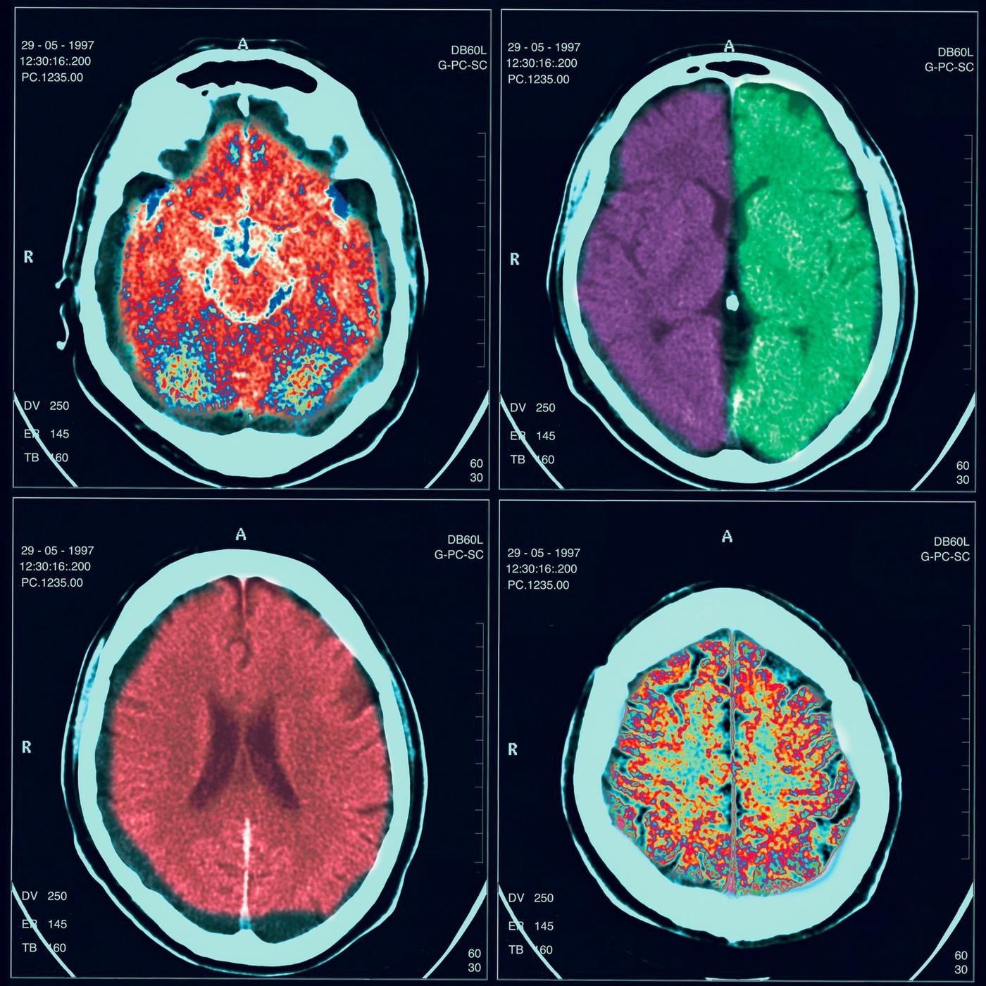 Things To Know If Your Child Needs A CT Scan - Seattle Mama Doc ...