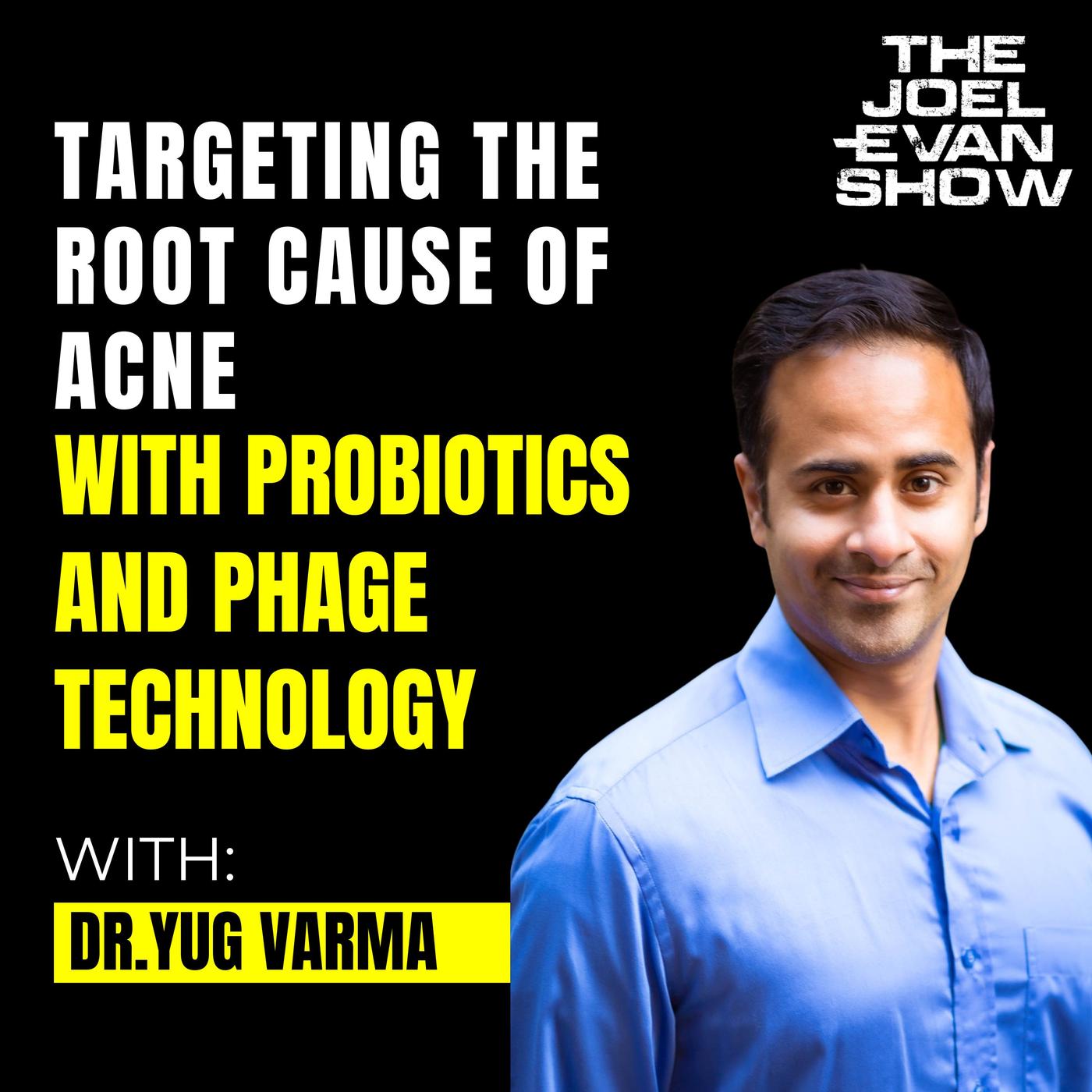 Targeting the Root Cause of Acne with Probiotics - Dr. Yug Varma [Phyla ...
