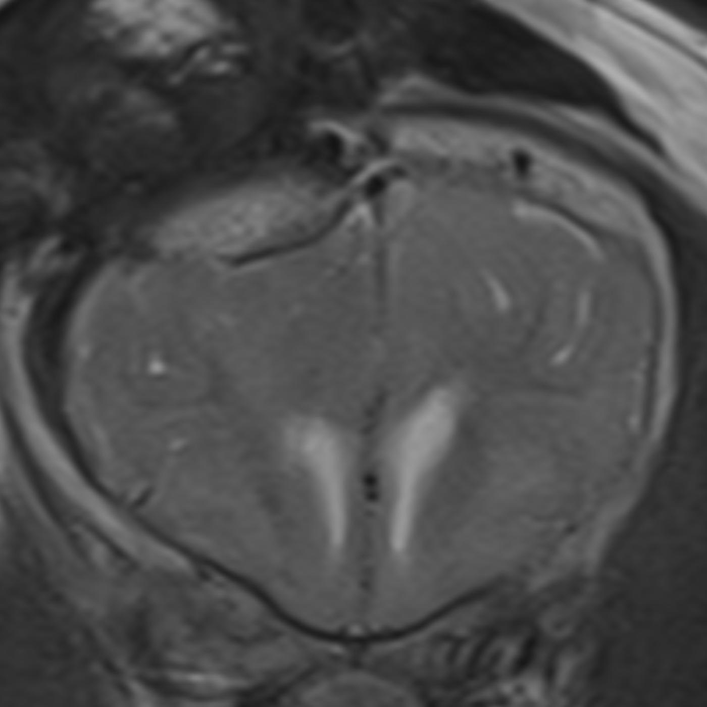 MRI and CT of Skull Fractures - Web-Vet Neurology Specialists - Feed ...