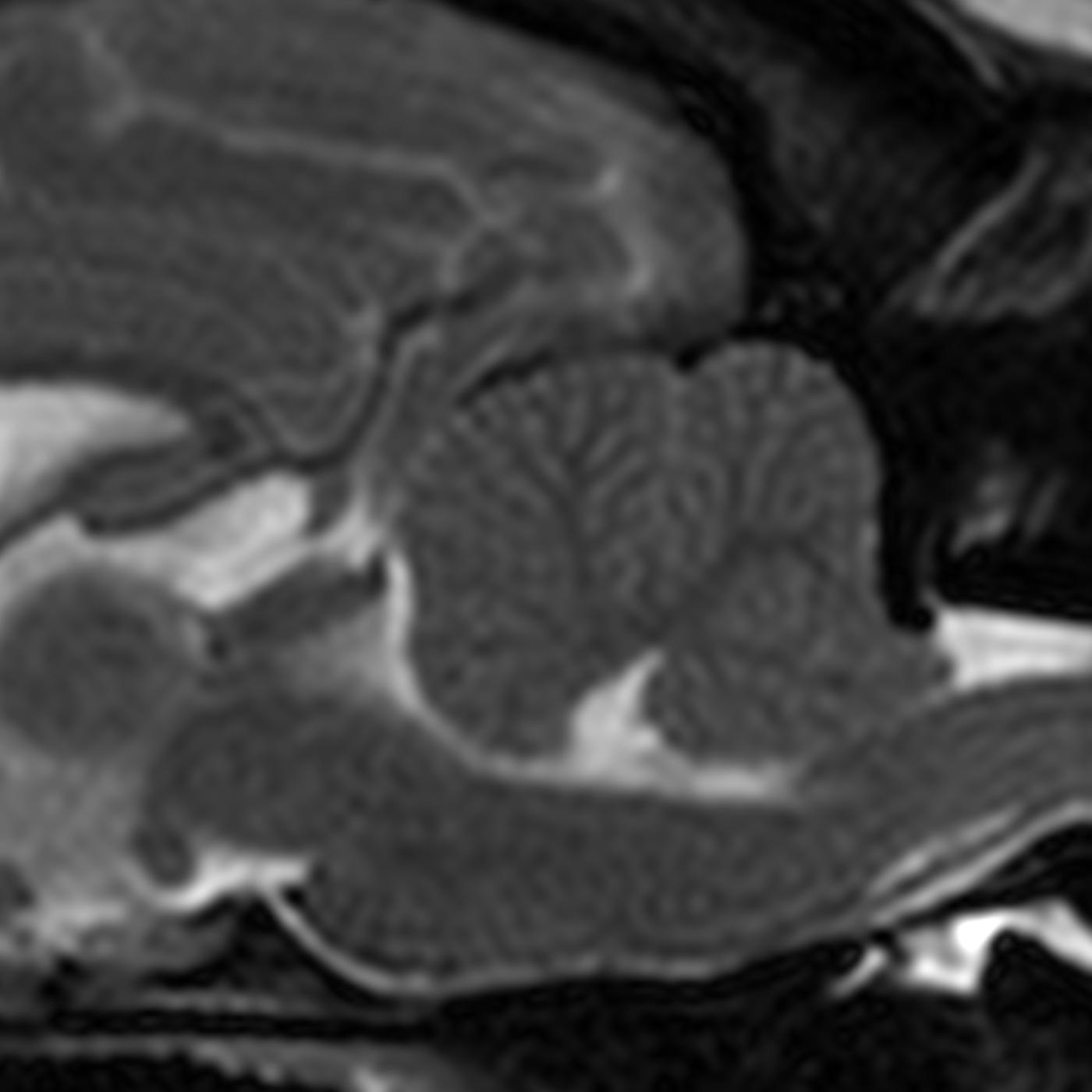 MRI and CT of Skull Fractures - Web-Vet Neurology Specialists - Feed ...