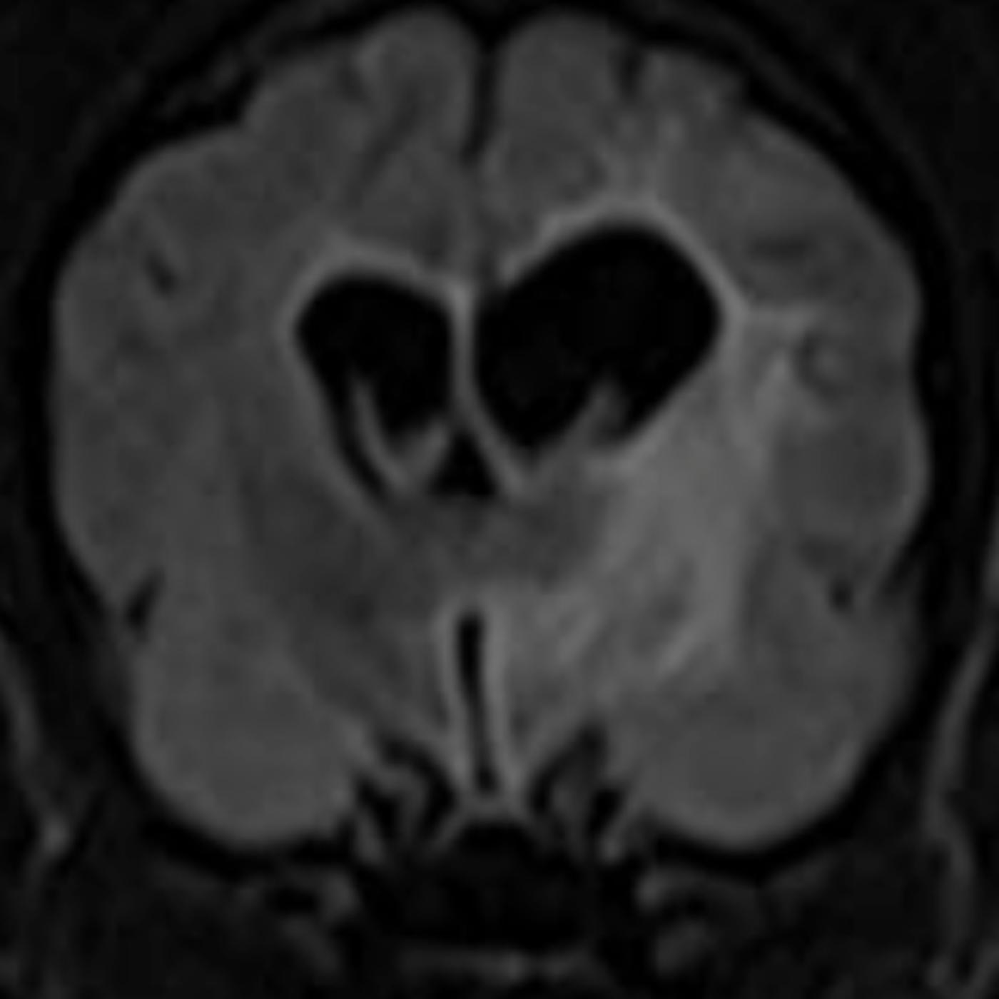 MRI and CT of Skull Fractures - Web-Vet Neurology Specialists - Feed ...