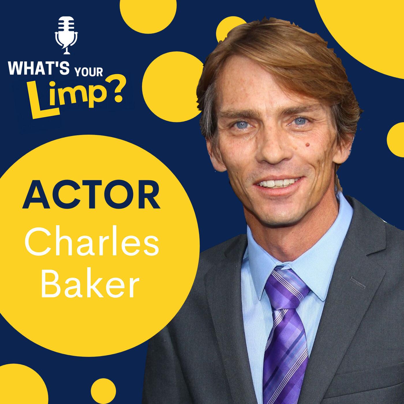 Charles Baker: Being Abandoned as a Child - What’s Your Limp? (podcast ...